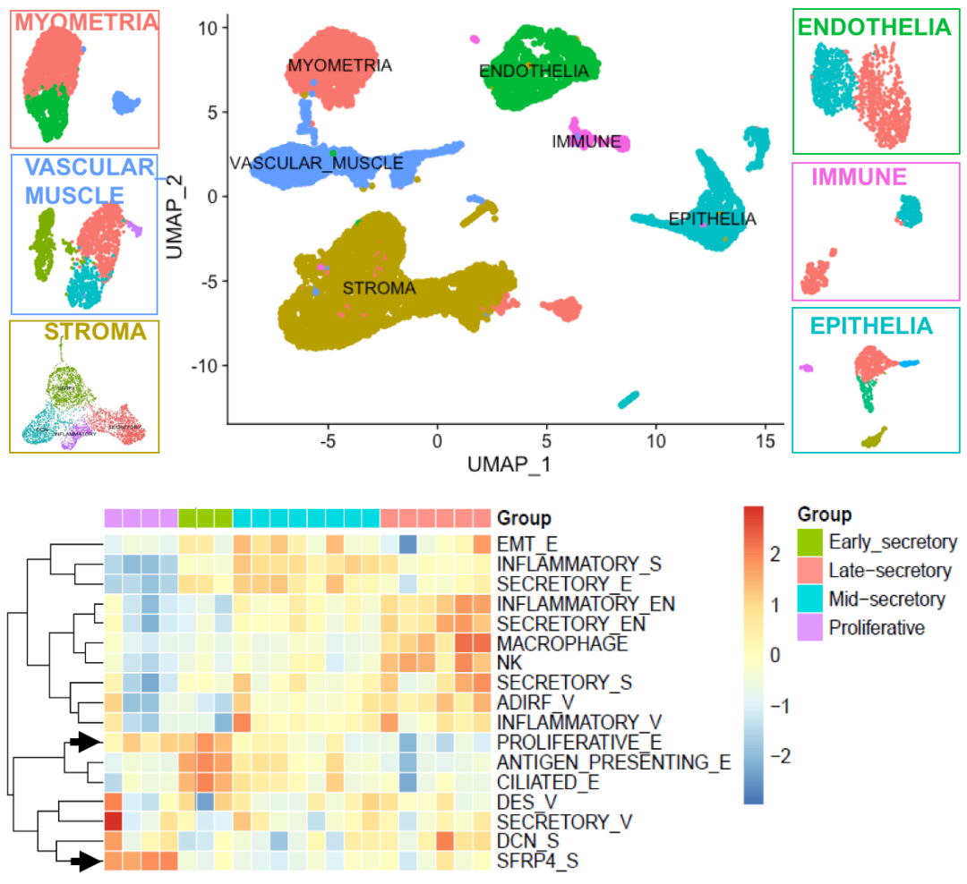 SFRP4+ stromal cell subpopulation with IGF1 signaling in human ...
