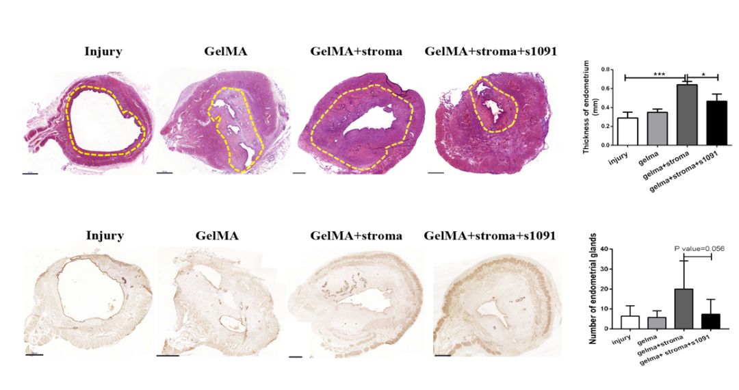 Sfrp4 Stromal Cell Subpopulation With Igf1 Signaling In Human