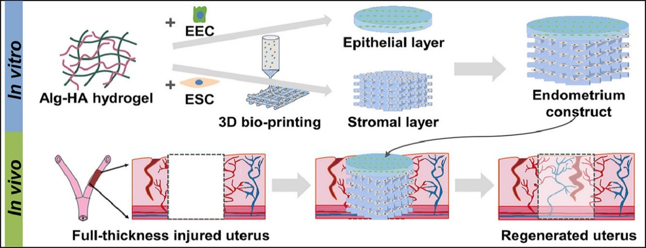 ZOU Xiaohui 's team fabricated a functional bilayer endometrium ...