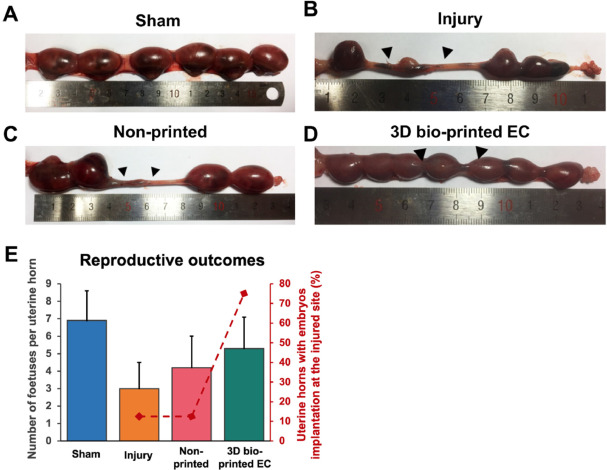ZOU Xiaohui 's team fabricated a functional bilayer endometrium ...